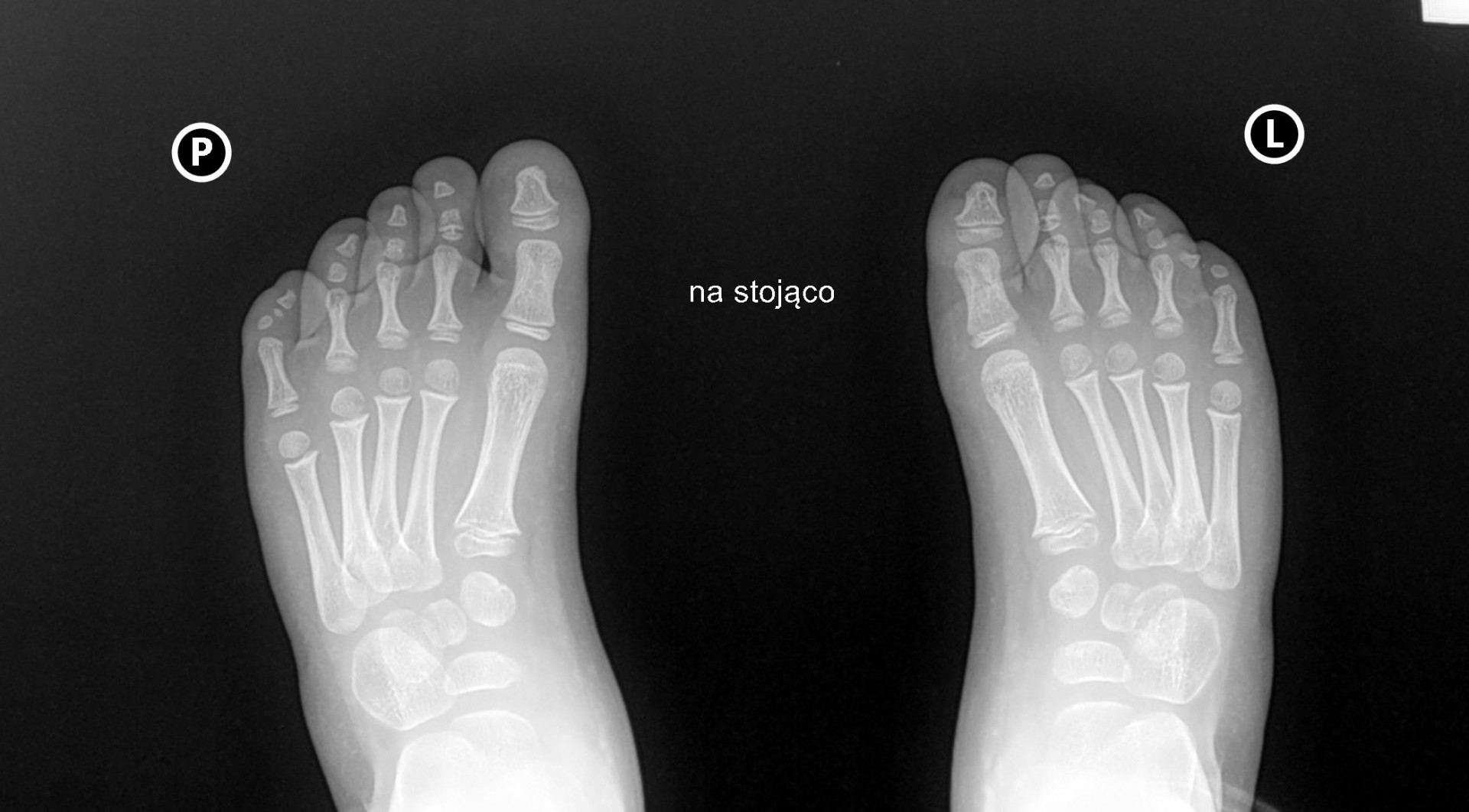 Rentgen Nowa Huta RTG Kraków Pracownia Cyfrowej Diagnostyki Obrazowej