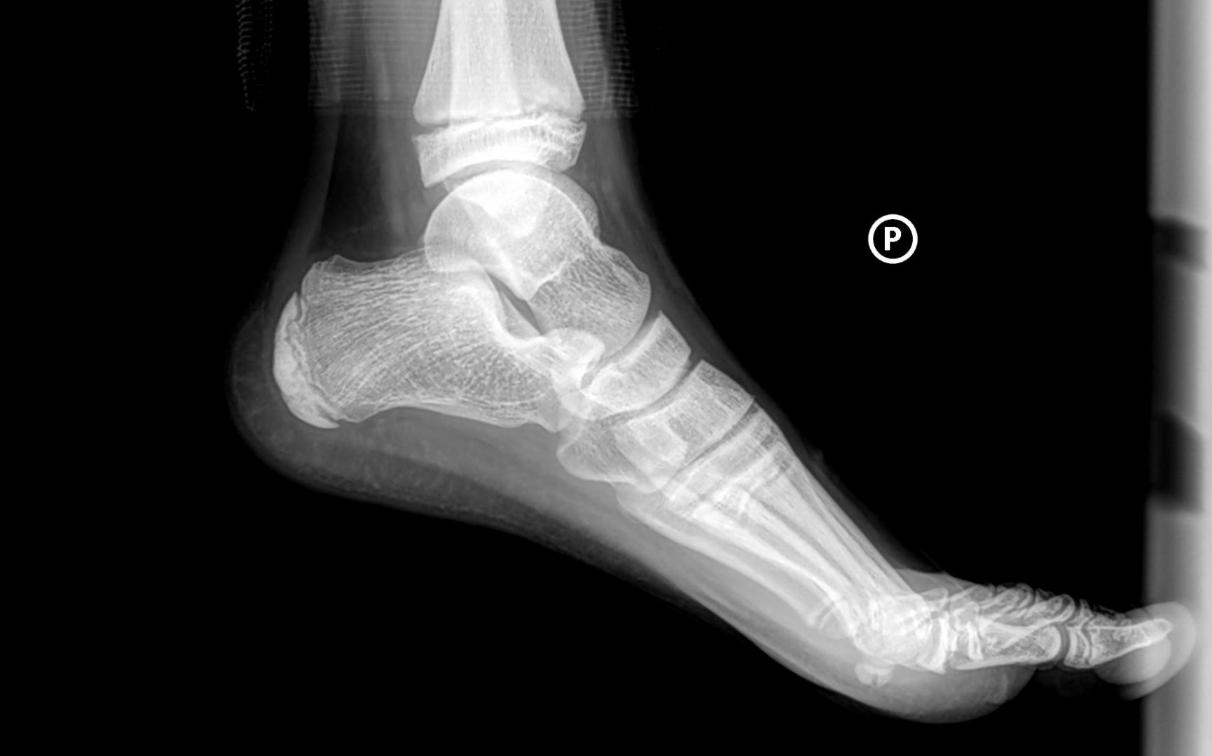 Rentgen Nowa Huta RTG Kraków Pracownia Cyfrowej Diagnostyki Obrazowej